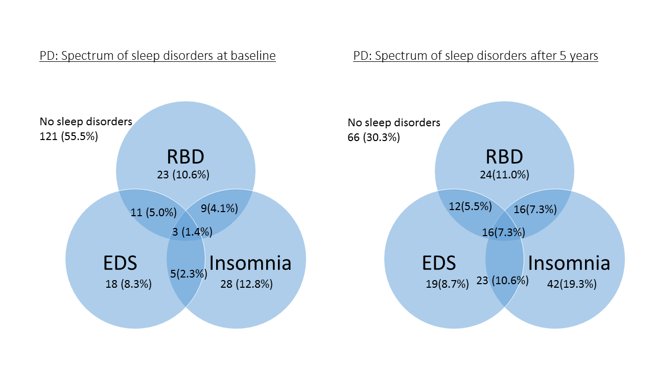 Sleep Apnoea|Unlocking The Alarming Link Between Sleep Disorders And Parkinson's Disease